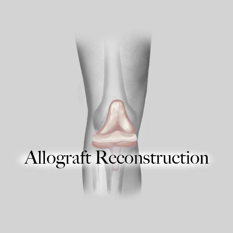 | THERAPEUTICAL AND RESEARCH CENTER OF MUSCULOSKELETAL TUMOR